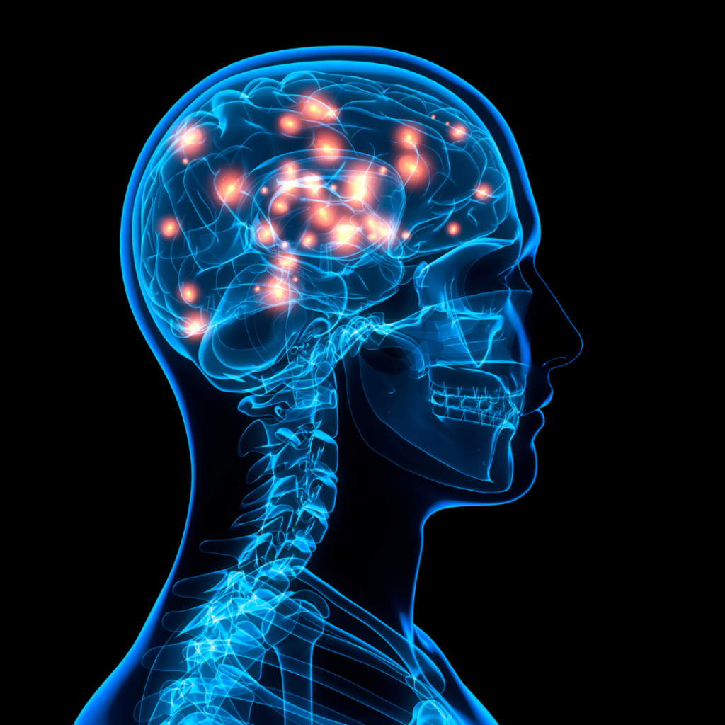 Stellate Ganglion Block (SGB) Therapy | Ketamine Infusion Center